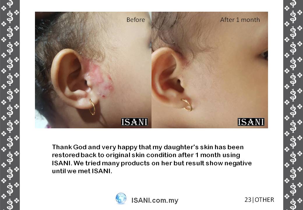 FREE 2 SETS ISANI TRAVEL BAR- EXCLUSIVE FOR NEW CUSTOMERS - ISANI Malaysia